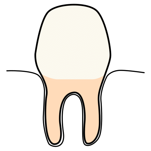 dent - dentaire - dentition - denture
